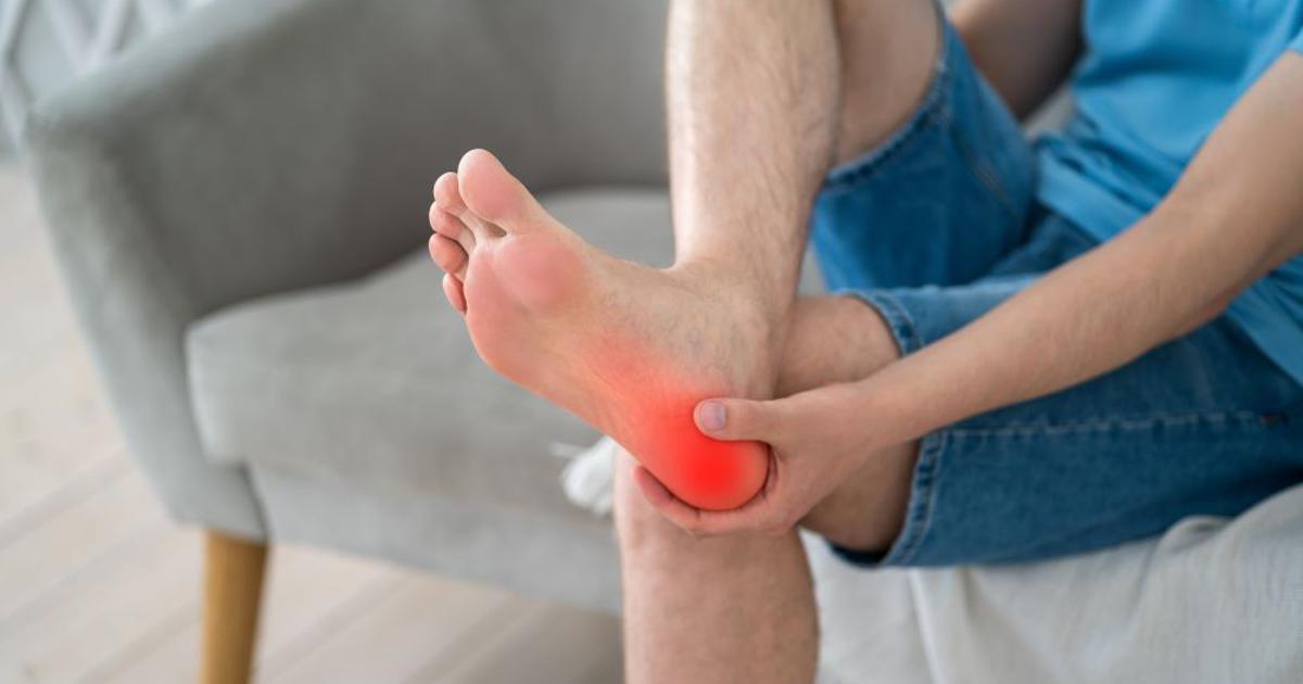 Platfus - Kako odpraviti plosko stopalo? - Žurnal24